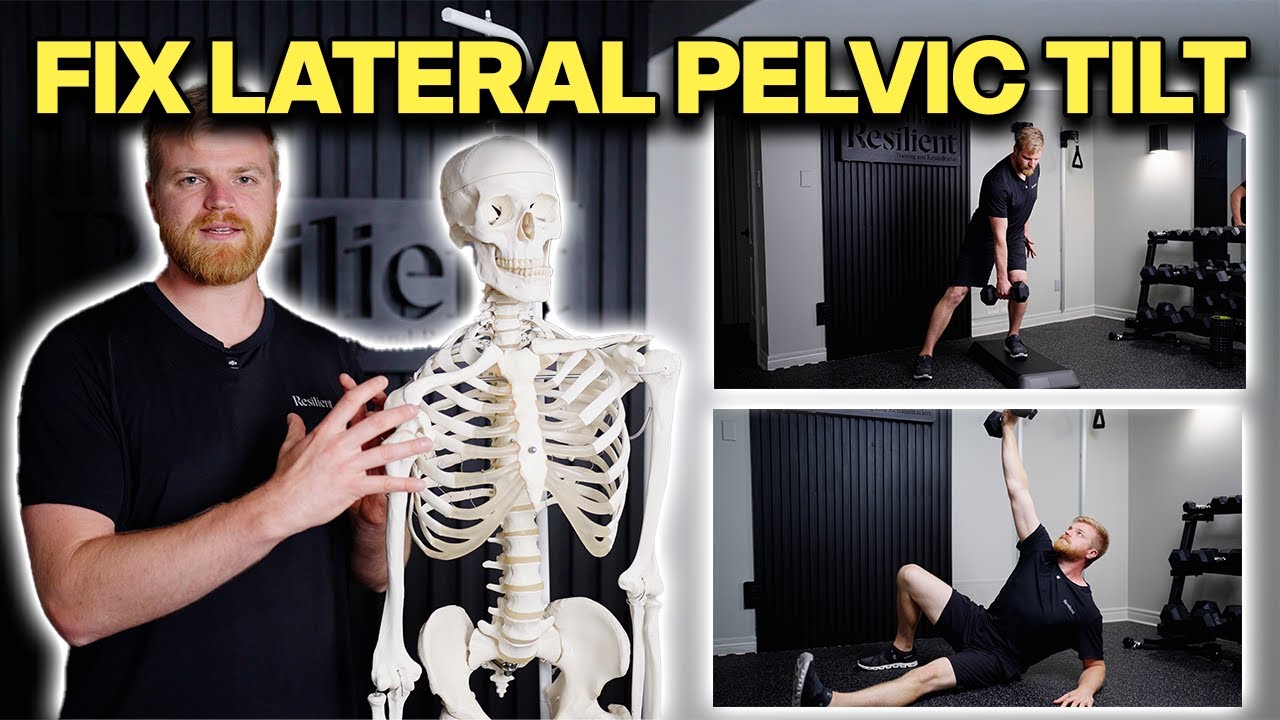 How to Correct Lateral Pelvic Tilt (Exercises That Actually Work) - YouTube