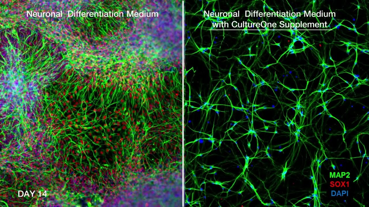 Gibco CultureOne Supplement: Superior Neuronal Cell Culture - YouTube