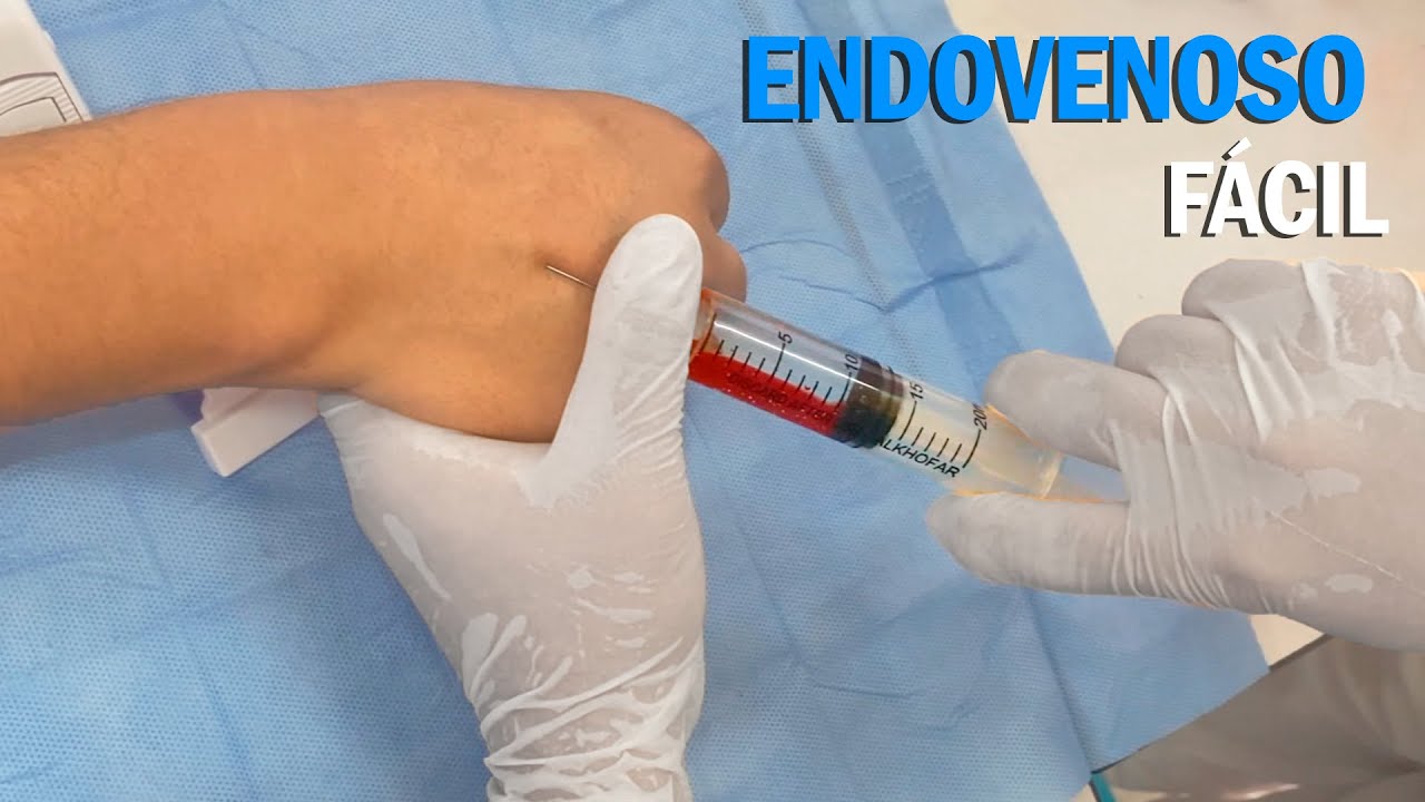 Cómo poner una Intravenosa (MANO) – Fácil - YouTube