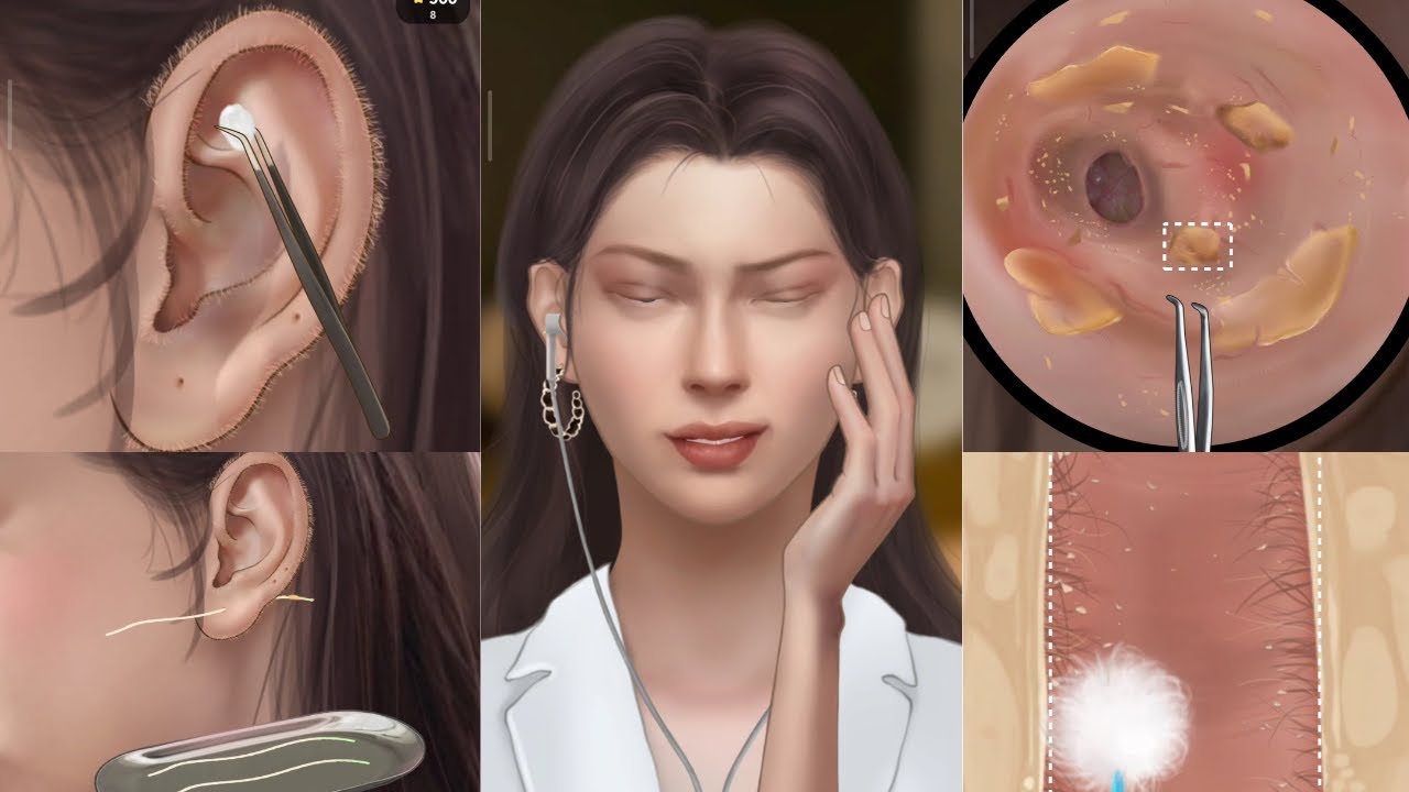 ASMR | Ear wax removal and ear cleaning -@MakeupASMR24 #asmr # ...