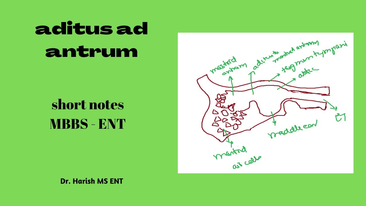 Aditus ad antrum | MBBS - ENT - YouTube