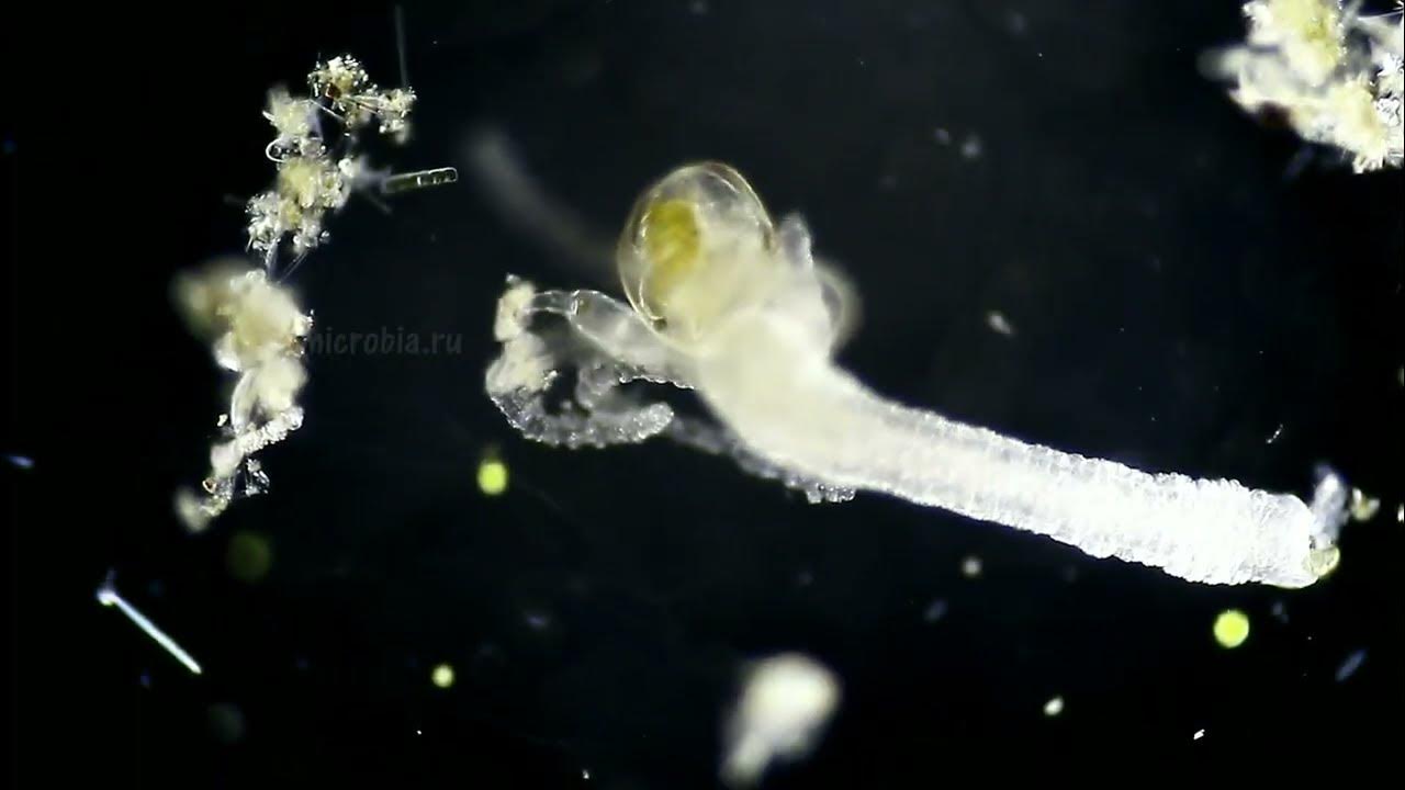 Hydra feeding/ Гидра пожирает рачка - YouTube