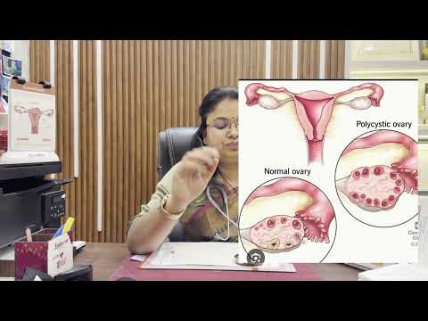 प्रेगनेंसी का बार-बार ख़राब होना#recurrent pregnancy loss#causes#blighted ovum #miscarriage 