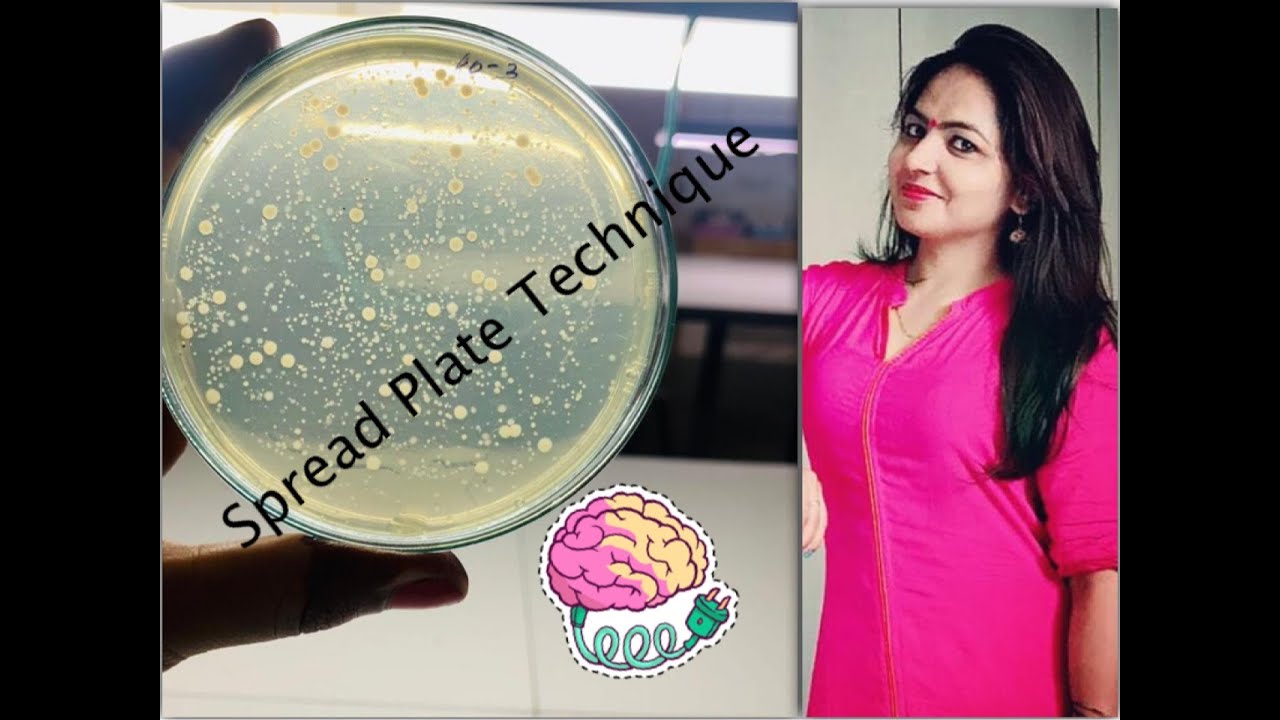 How To Perform Spread Plate Technique/Standard Plate Count (SPC) - YouTube