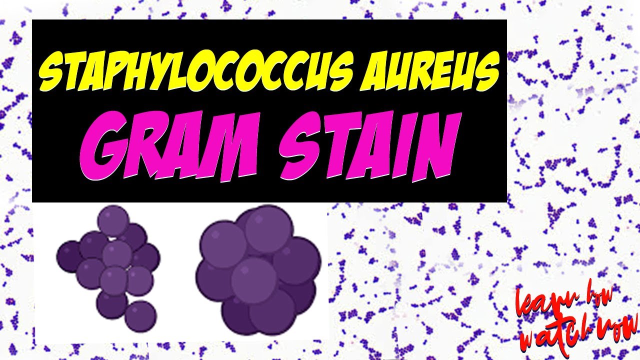 Gram Stain Staphylococcus Aureus