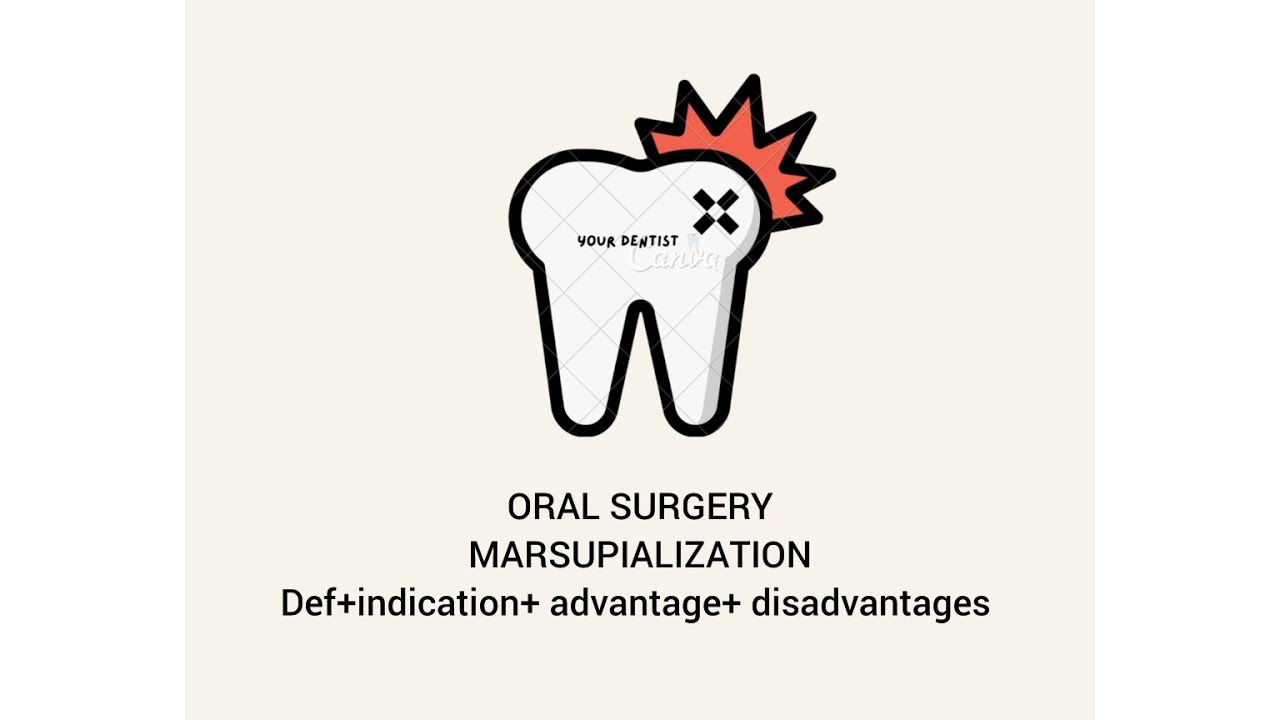 ORAL SURGERY MARSUPIALIZATION (Def+indication advantage+disadvantages ...