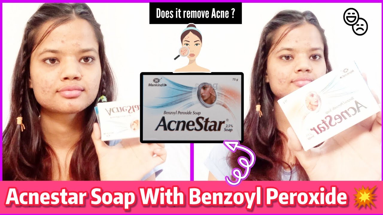 Acnestar Soap I How to use ? Results | Honest Review | How to get rid ...