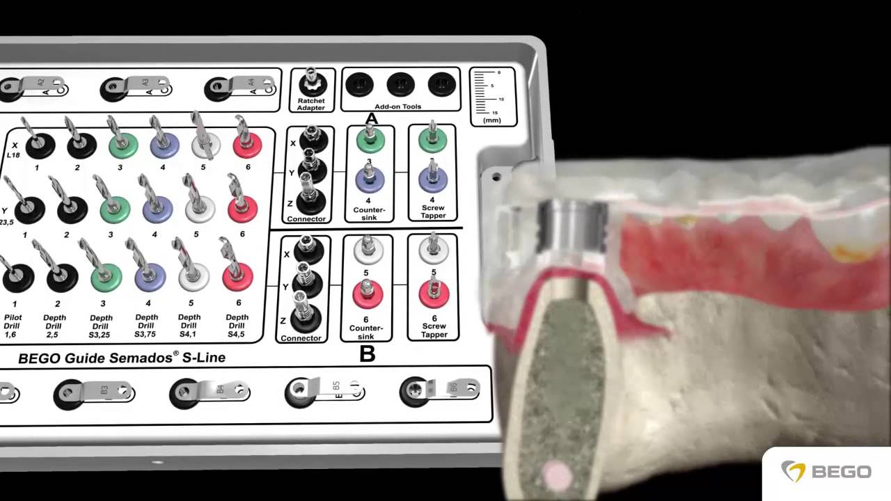 Протокол навигационной хирургии BEGO Guide - YouTube