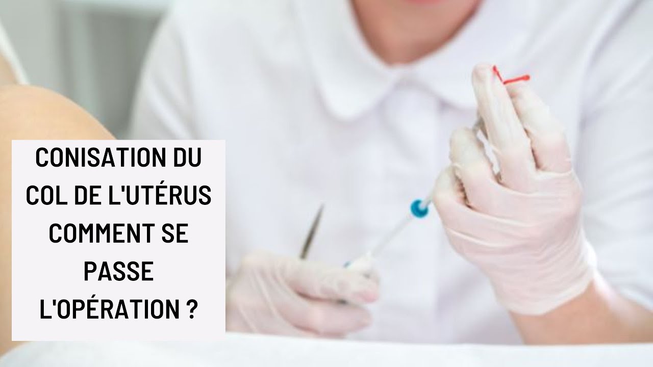 Conisation Comment se passe l'opération ? - YouTube