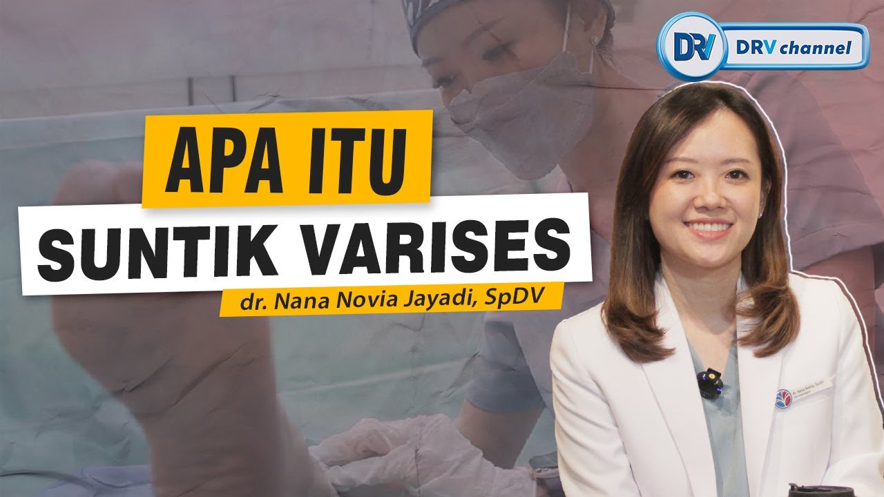 dr Nana | Apa Itu Suntik Varises. Seperti Apa Tanda dan Gejala Varises ...