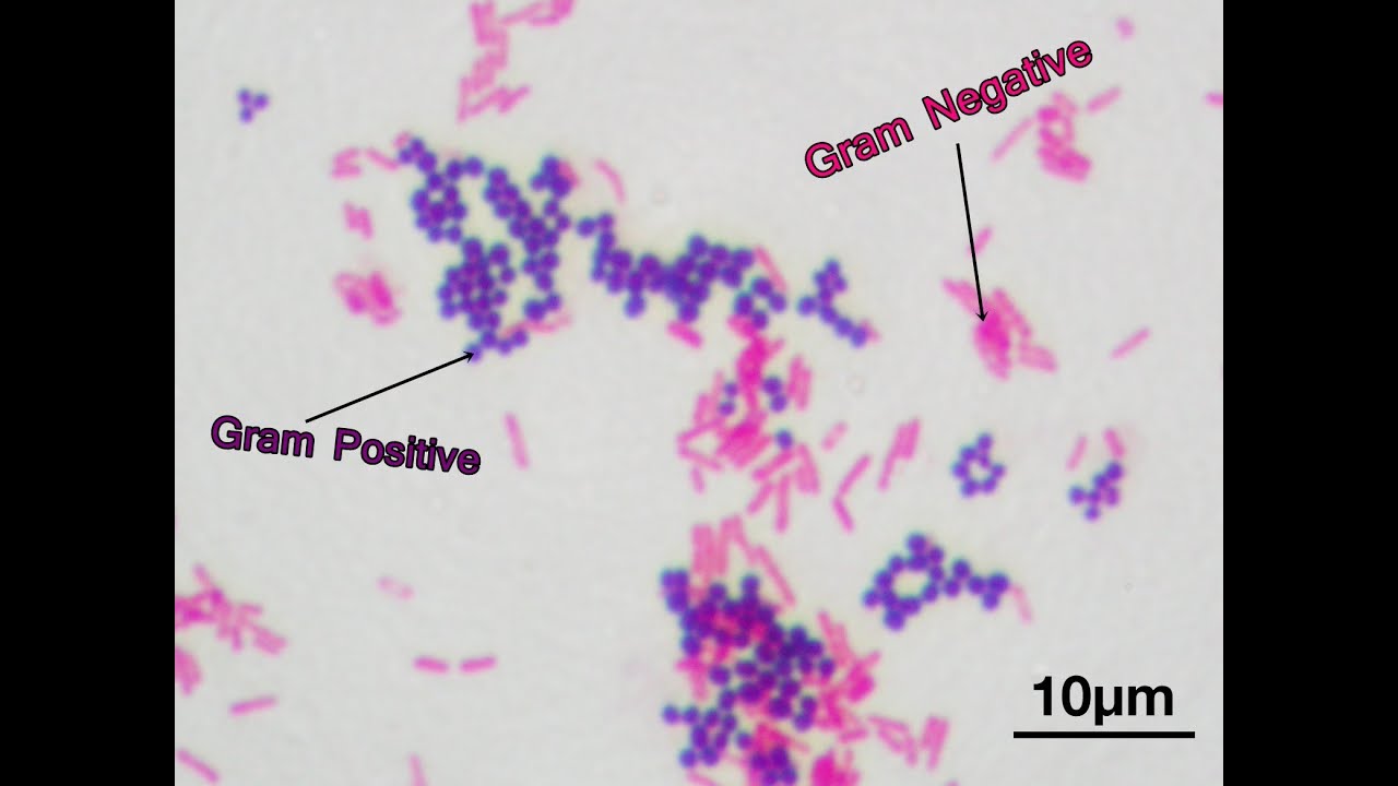 Gram Stain Project - YouTube