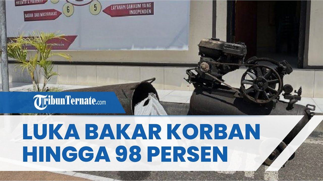 Insiden Kompor Mayat Meledak, Korban Alamin Luka Bakar hingga 98 Persen ...