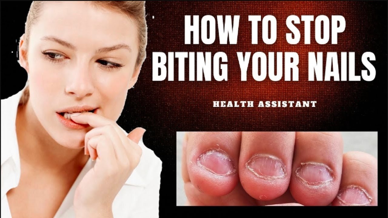 How To Stop Biting Your Nails | Nail Biting Anxiety |Is Nail Biting A ...
