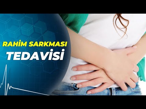 Rahim sarkması nasıl tedavi edilir? - Sağlıklı Günler