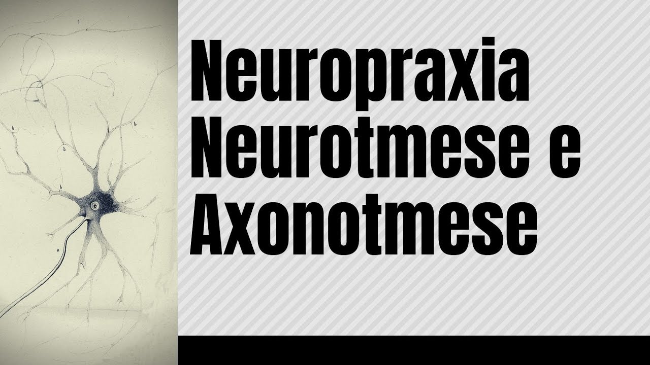 Neuropraxia Axonotmese E Neurotmese - RETOEDU