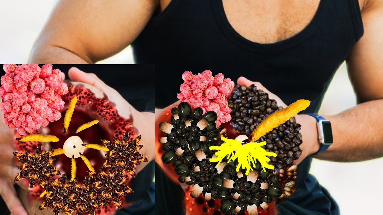 ASMR dog tick and maggot removal infected leg | ASMR leg treatment ...