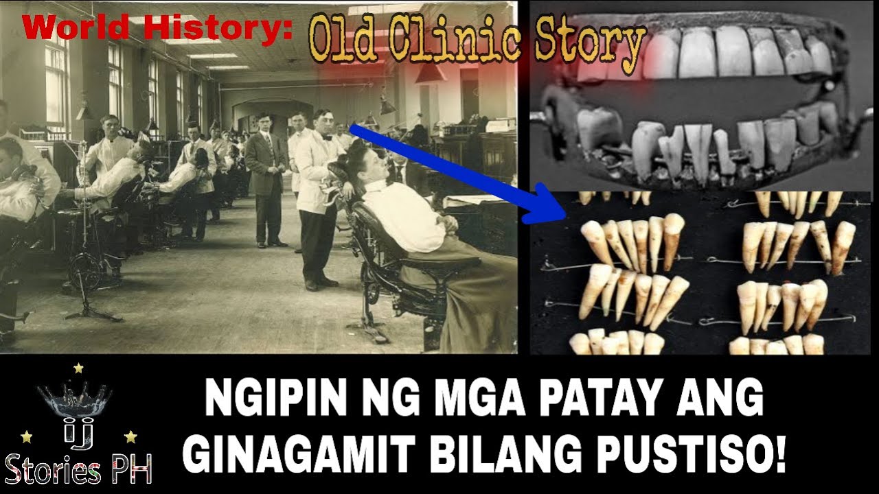 Sinaunang paggawa ng mga Pustiso | ij Stories PH - YouTube
