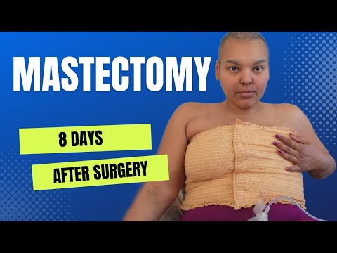 This is how I'm doing after my mastectomy * Cancer vlog - YouTube