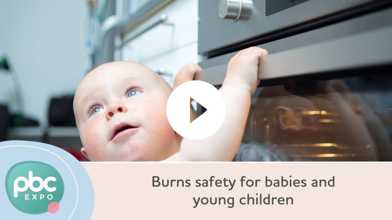 Burns safety for babies and young children - YouTube