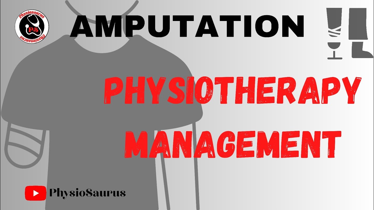 Amputation | Physiotherapy management - YouTube