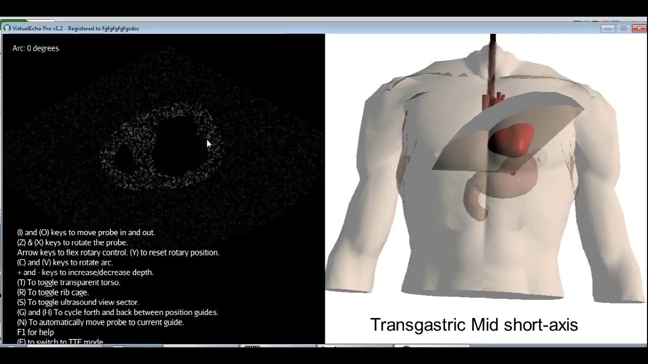 How to get the standard transesophageal echocardiography (TEE) views ...