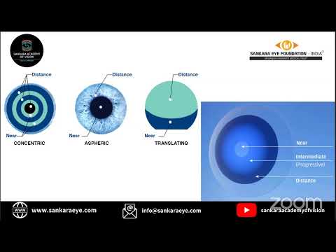 Managing Presbyopia with Contact lens Learn from the Masters - Sankara ...