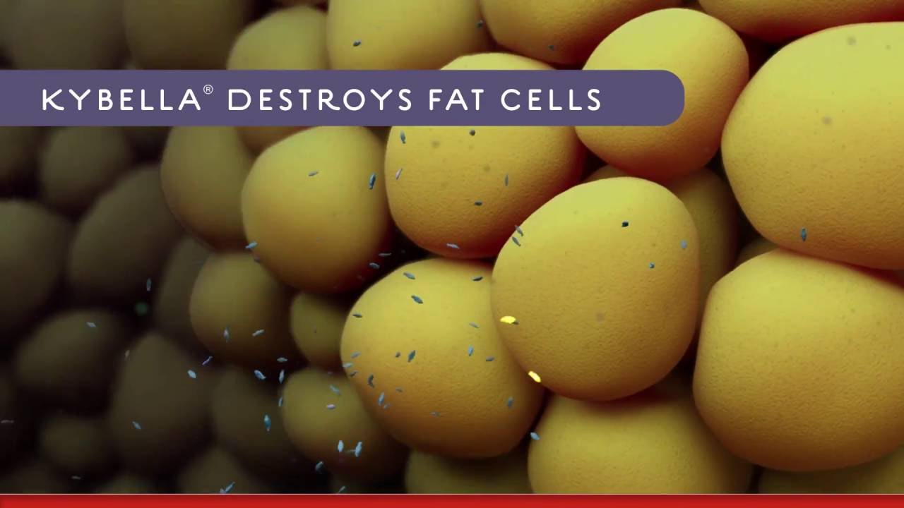 What is Kybella & How does Kybella work? - YouTube