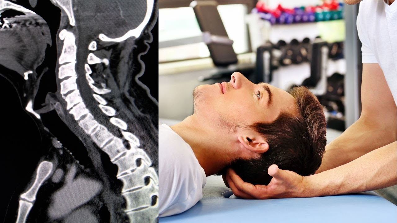 "Unlocking Whiplash: An In-Depth Analysis with Dr. Jonathan Kuttner MD ...