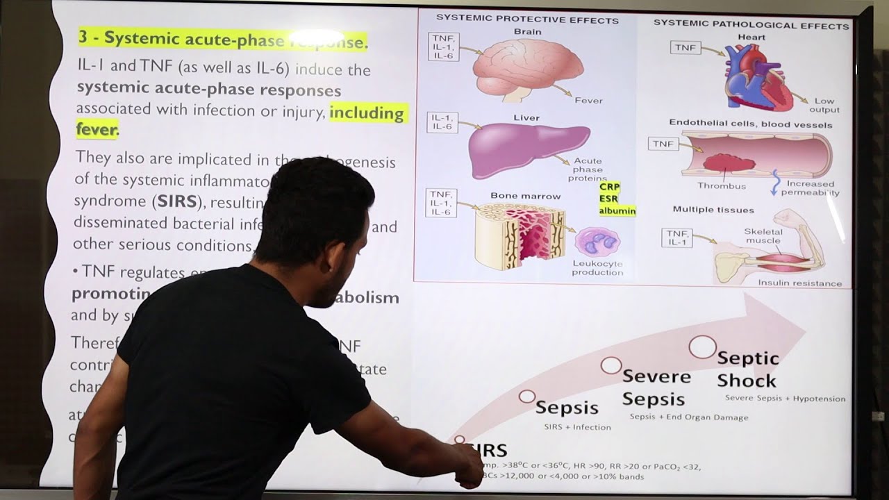 SIRS vs Sepsis vs Severe Sepsis Vs Septic Shock - YouTube