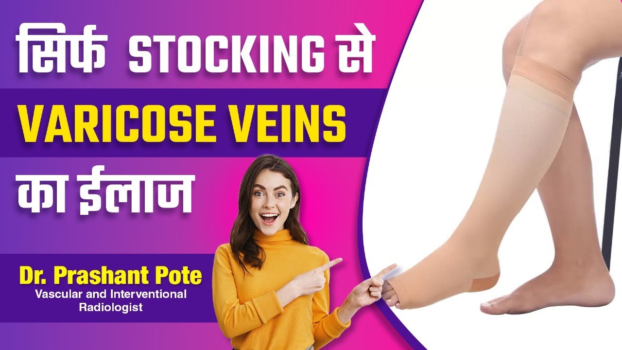 Varicose Veins Care: How to Choose and Use Stockings Complete Guide by ...