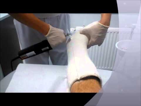 ściąganie gipsu - YouTube