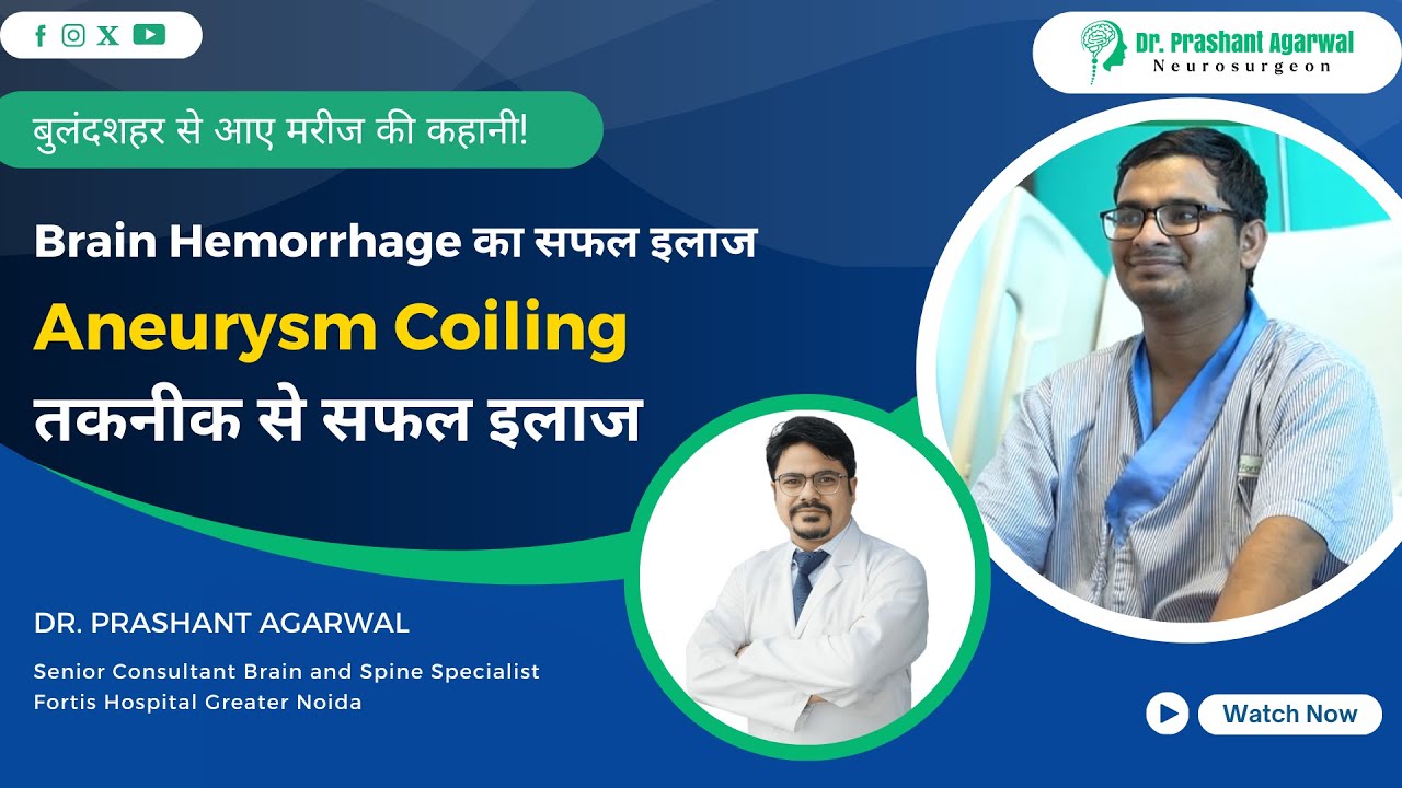 Aneurysm Coiling Technique | A successful recovery | Brain Hemorrhage | Dr. Prashant Agarwal ...