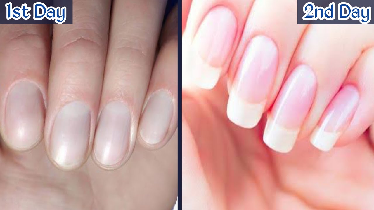 How to Grow Nails in 2 days || Fast Nail Growth in just 2 days || How ...