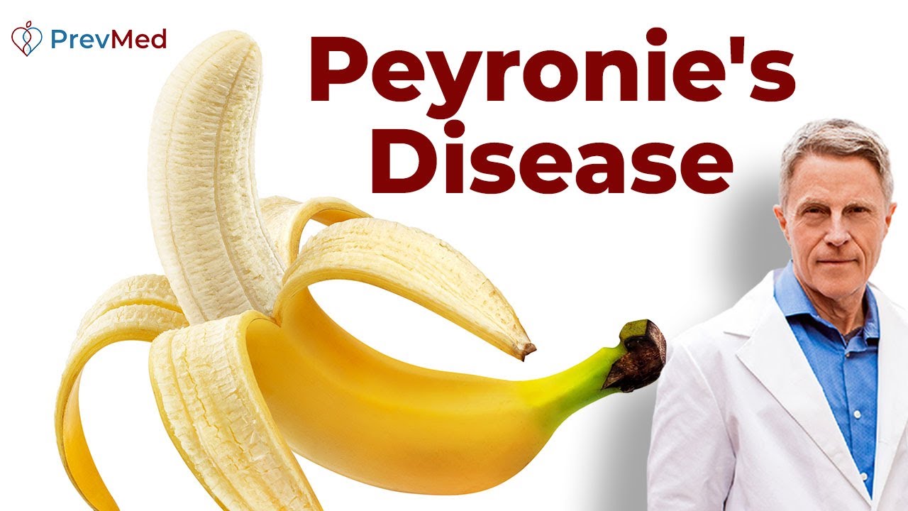 Peyronie’s Disease: Is Your Penis Warning You About Type 2 Diabetes ...
