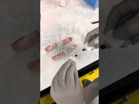 Bone Marrow Slide Creation - YouTube