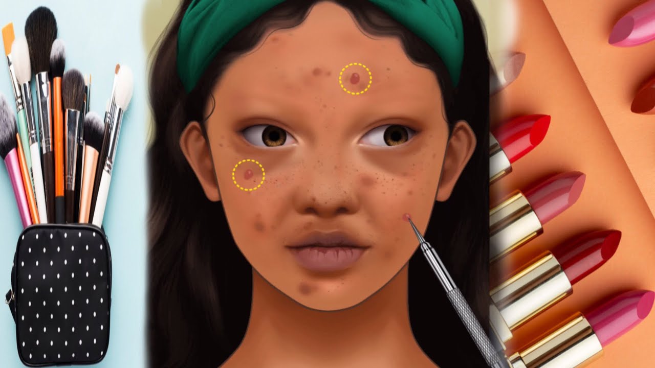 Spa treatment Asmr Animation |Pimple Popping | Acne Removal | Smile ...