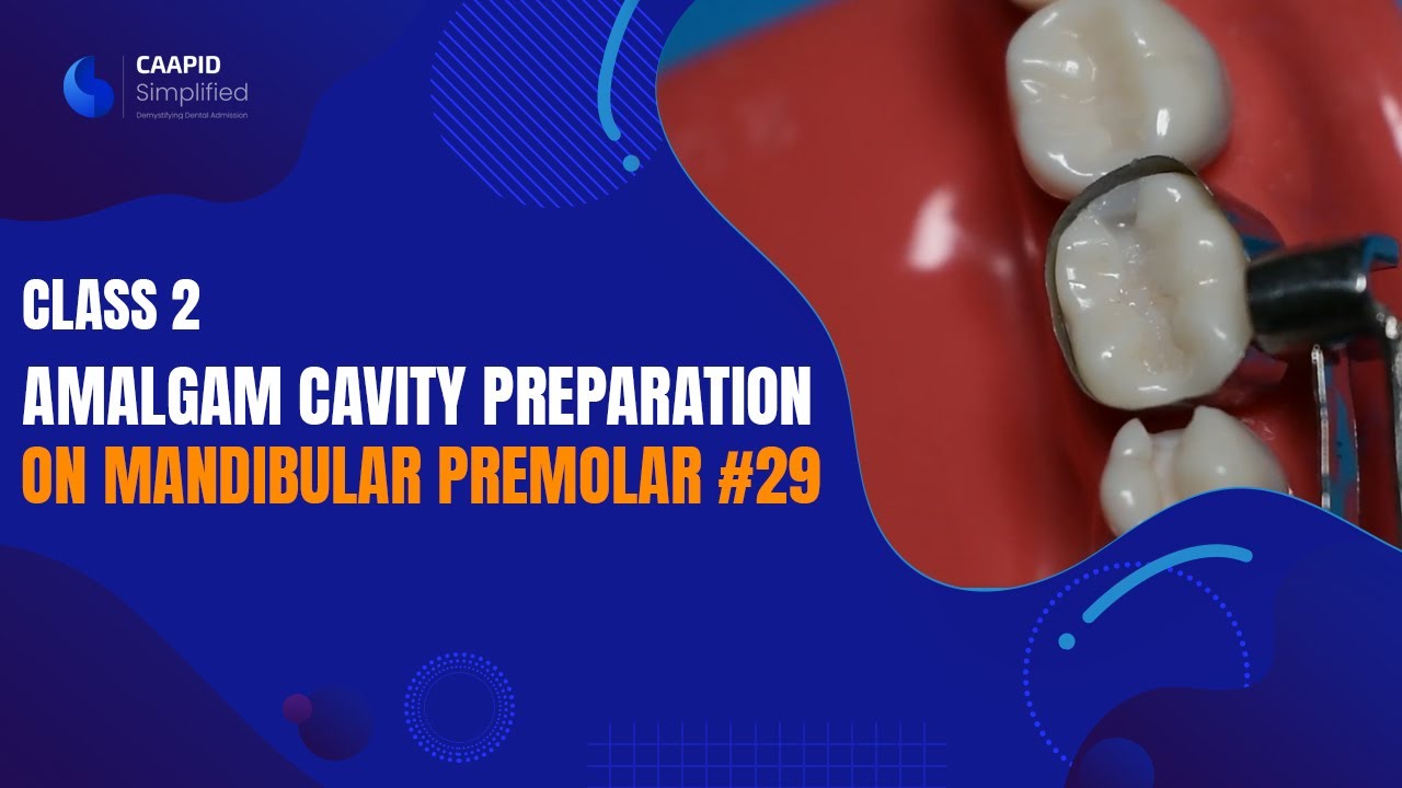 Class 2 Amalgam Cavity Preparation on Mandibular Premolar #29 | Caapid ...