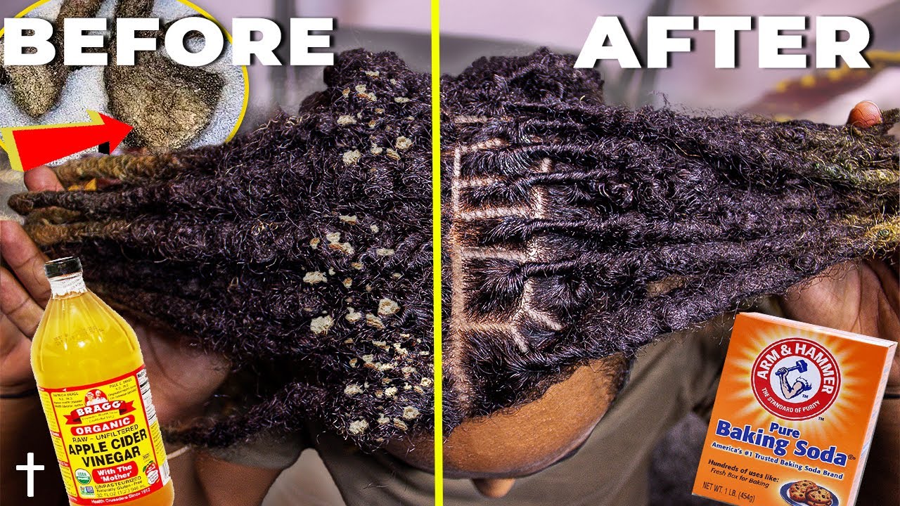 HOW TO ACV RINSE YOUR DREADLOCKS | Step By Step Tutorial - YouTube