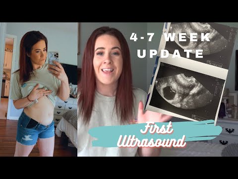 4-7 WEEKS PREGNANCY UPDATE | SYMPTOMS, BELLY SHOT + FIRST ULTRASOUND