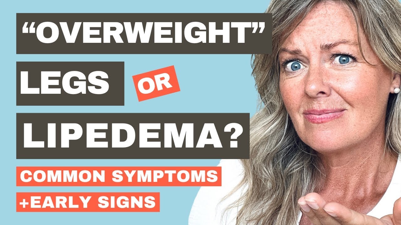 Common Symptoms and Signs of Lipedema (Legs Feeling Weird? Watch This ...