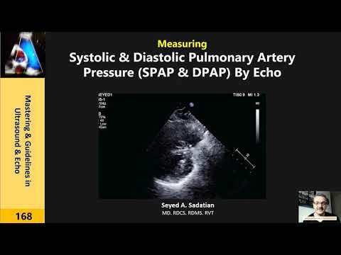 Systolic & Diastolic Pulmonary Artery Pressure Measurement By Echo ...