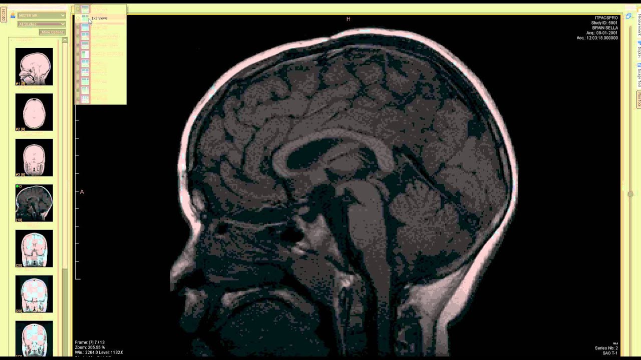 FREE Web Based Dicom Imaging - YouTube