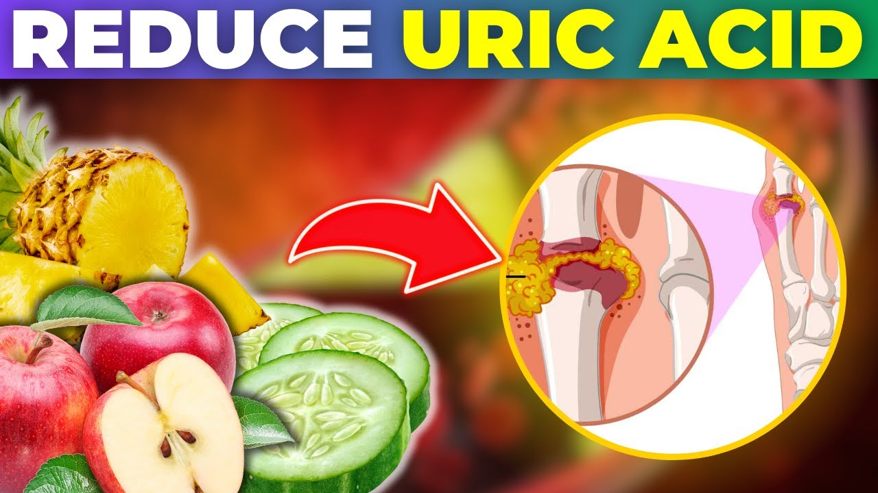 TOP 10 Foods to Lower Uric Acid Levels NATURALLY and EFFORTLESSLY - YouTube