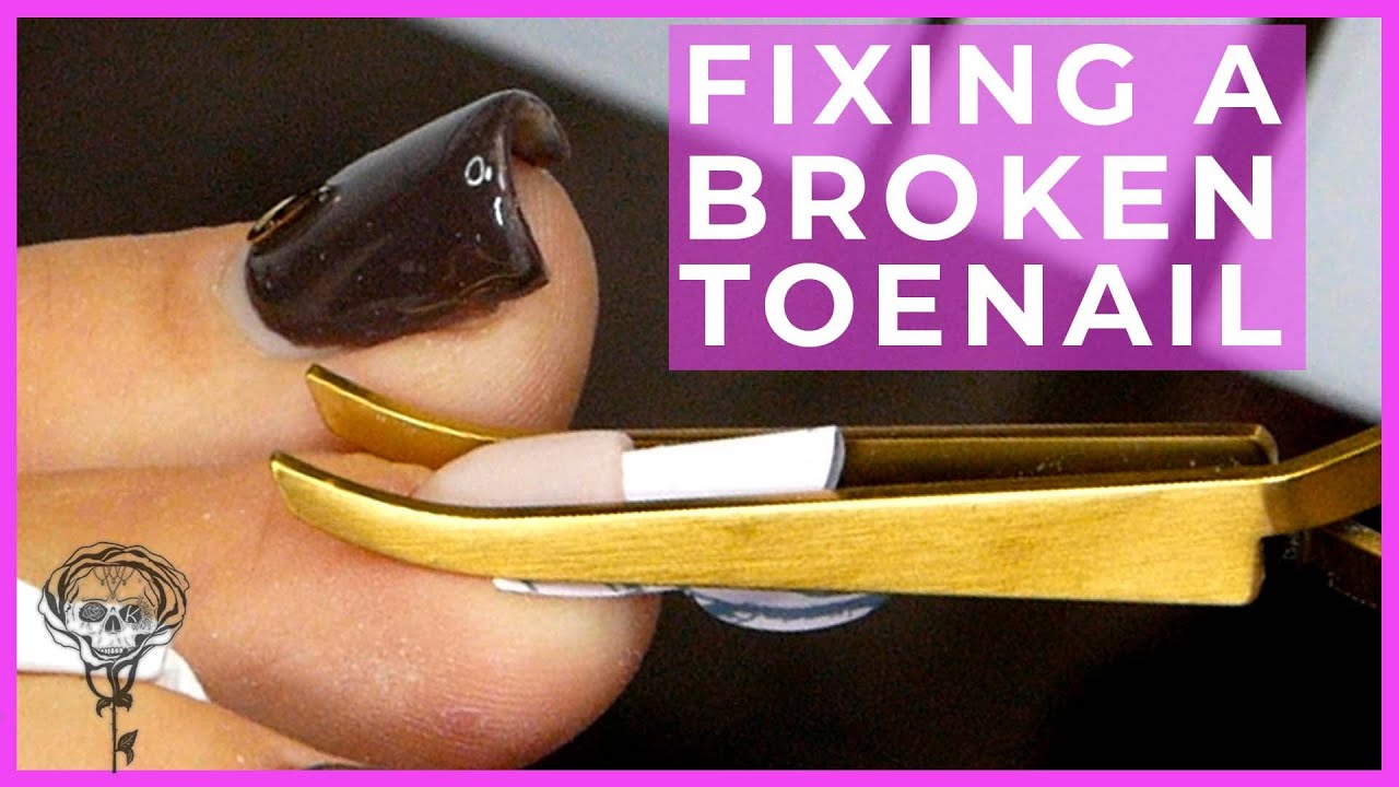 Fixing Fay's Gammy Toe with the Tiniest Ever Sculpting Form! - YouTube