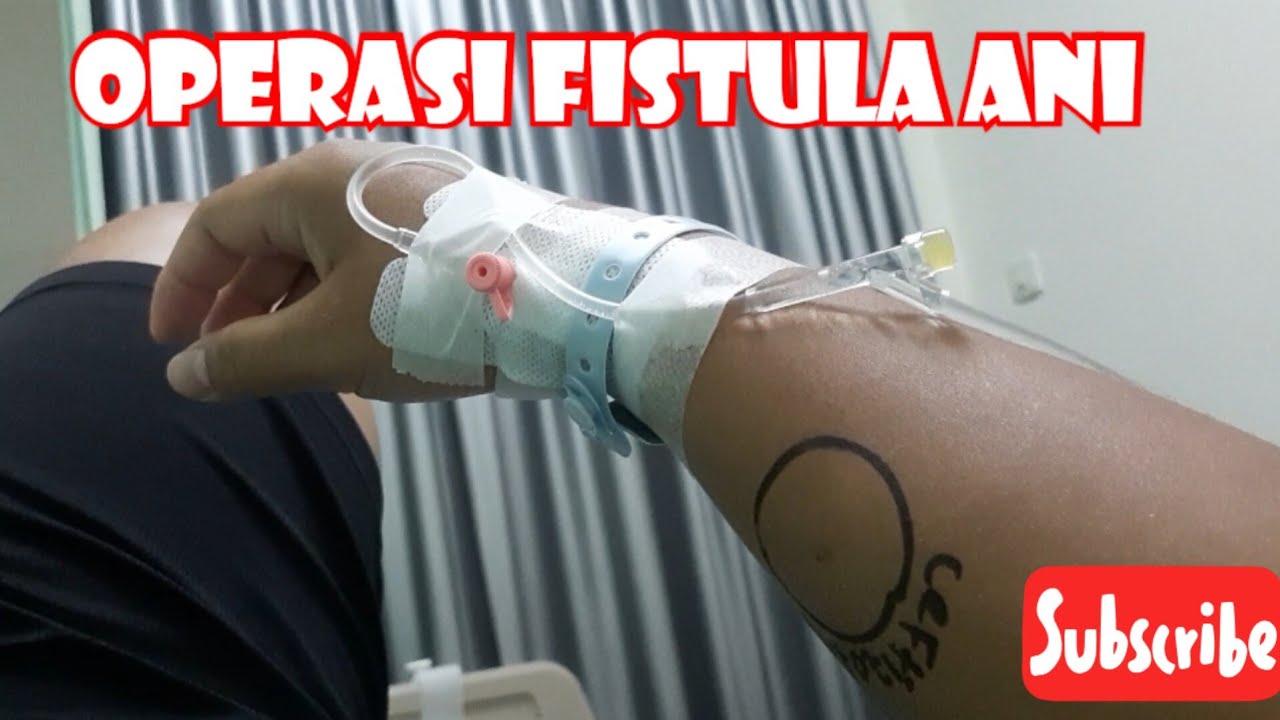 Menjelang Operasi Fistula Ani #fistula #fistulaani #operasifistula # ...