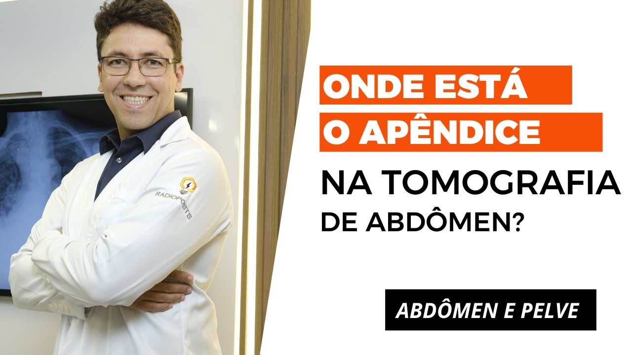 ENCONTRE O APÊNDICE NA TC - YouTube