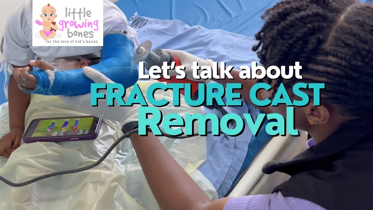 What You Must Know To Know About Fracture Cast Removal YouTube what-you-must-know-to-know-about-fracture-cast-removal-youtube