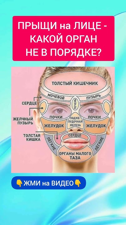 ПРЫЩИ на ЛИЦЕ Какой орган не в порядке прыщиналице акне Youtube