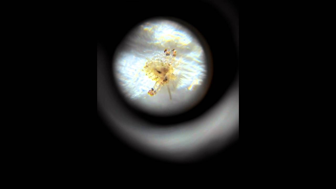 Pubic lice, 阴虱， 陰蝨， piojo púbico ， Pthirus pubis， crab louse，ケジラミ - YouTube