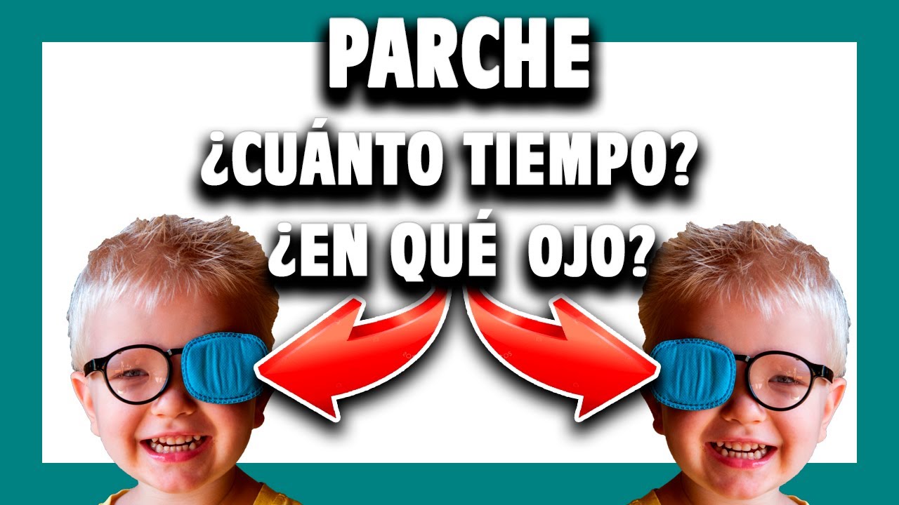 🟩 OJO VAGO: ¿en qué OJO poner el PARCHE? ¿Horas al día? [Cap. #8] - YouTube